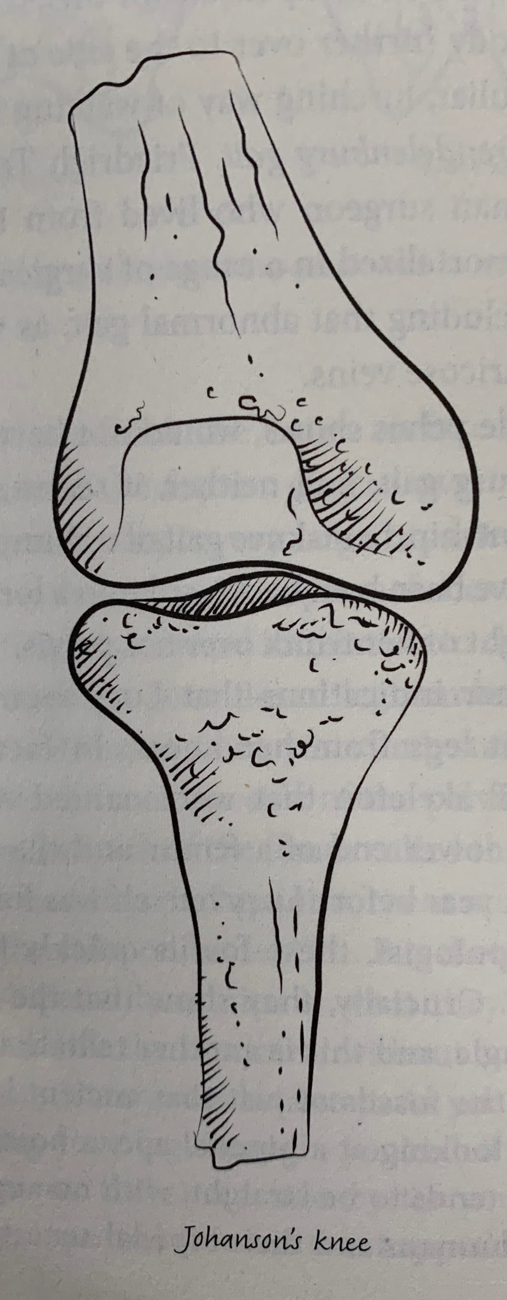 Chapter 10: Hip to Toe – The Incredible Unlikeliness of Being, Alice ...